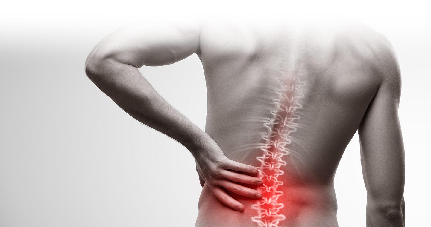 Broken Back Injury Compensation Claims – Comprehensive Guide - Claim ...
